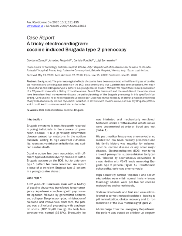 (PDF) A tricky electrocardiogram: cocaine induced Brugada type 2 phenocopy