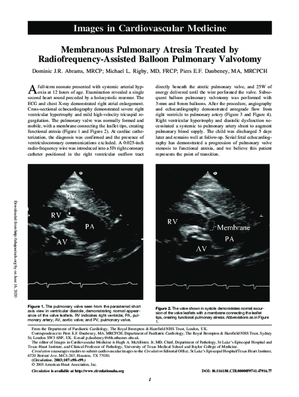 (PDF) Membranous Pulmonary Atresia Treated by Radiofrequency-Assisted ...