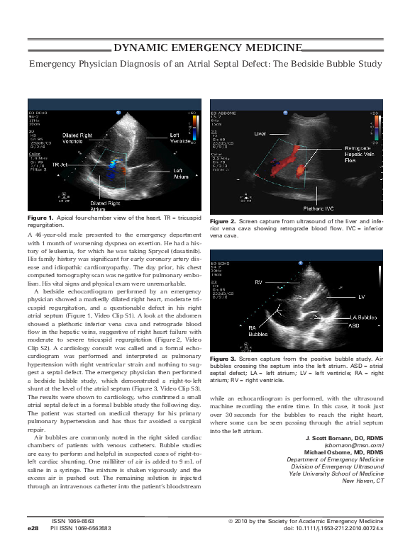 (PDF) Emergency Physician Diagnosis of an Atrial Septal Defect: The ...