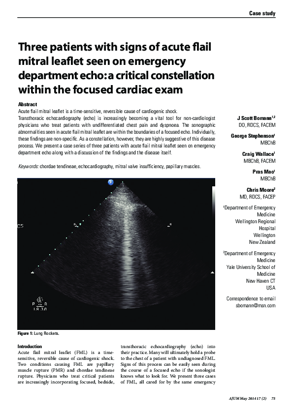 (PDF) Three patients with signs of acute flail mitral leaflet seen on ...