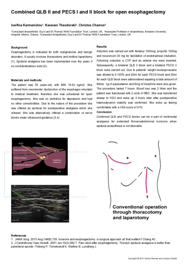 (PDF) Combined QLB II and PECS I block for open esophagectomy