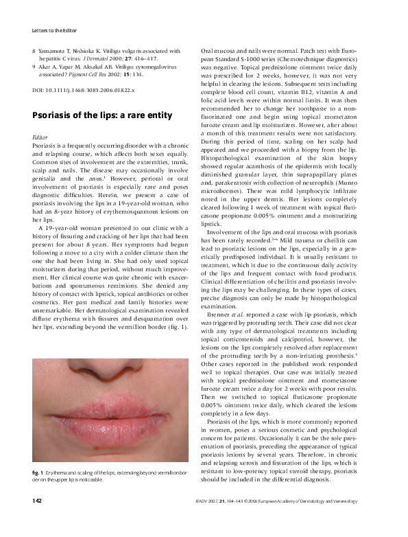 (PDF) Psoriasis of the lips: a rare entity