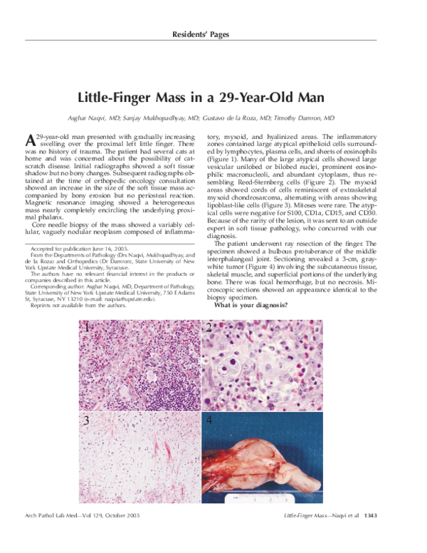(PDF) Little-finger mass in a 29-year-old man