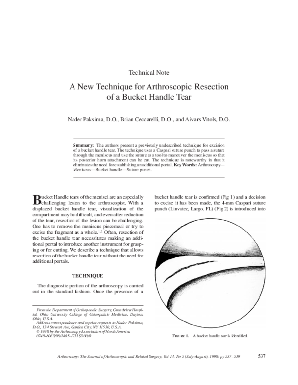 (PDF) A new technique for arthroscopic resection of a bucket handle tear