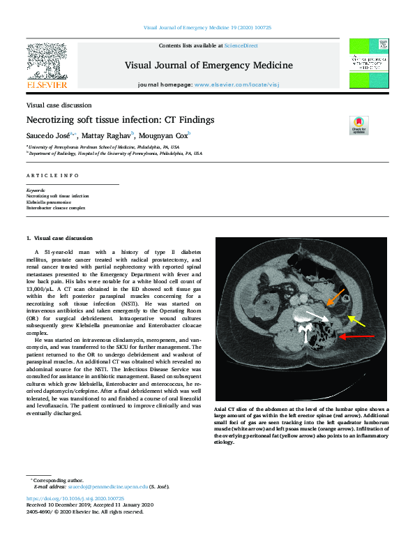 (PDF) Necrotizing soft tissue infection: CT Findings