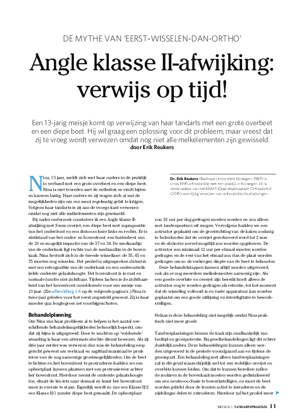 (PDF) Angle klasse II-afwijking: verwijs op tijd!