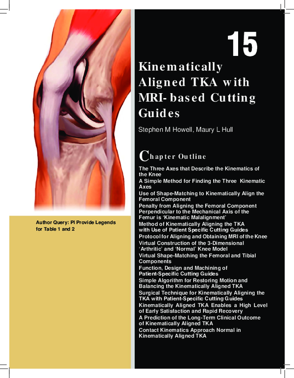 (PDF) Kinematically Aligned TKA with MRI-based Cutting Guides