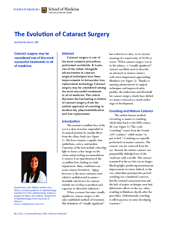 (PDF) Evolution of Cataract Surgery