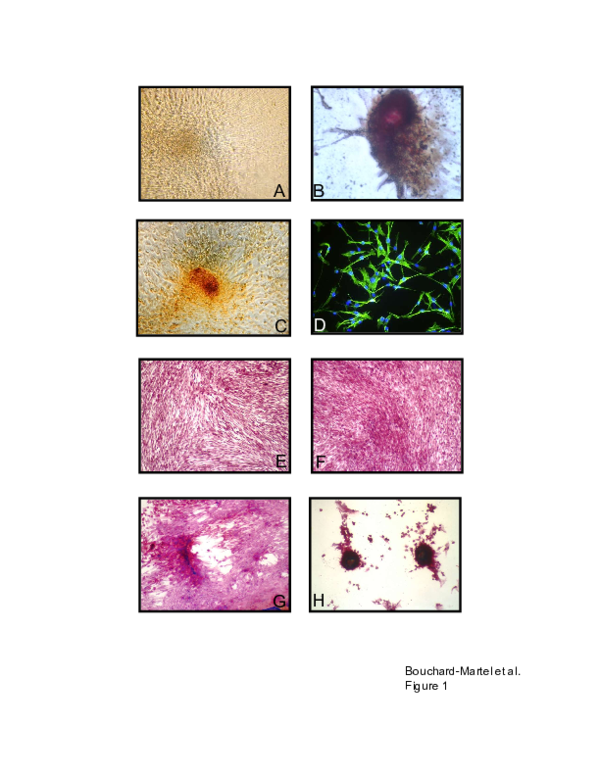 (PDF) Interstitial cells from left-sided heart valves display more ...