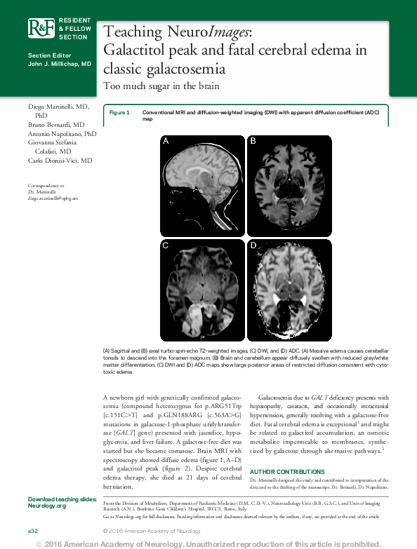 (PDF) Teaching NeuroImages: Galactitol peak and fatal cerebral edema in ...