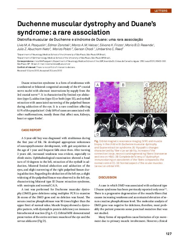 (PDF) Duchenne muscular dystrophy and Duane's syndrome: a rare association