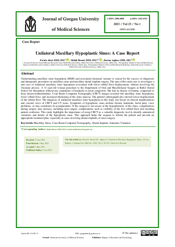 (PDF) Unilateral Maxillary Hypoplastic Sinus: A Case Report | Journal ...