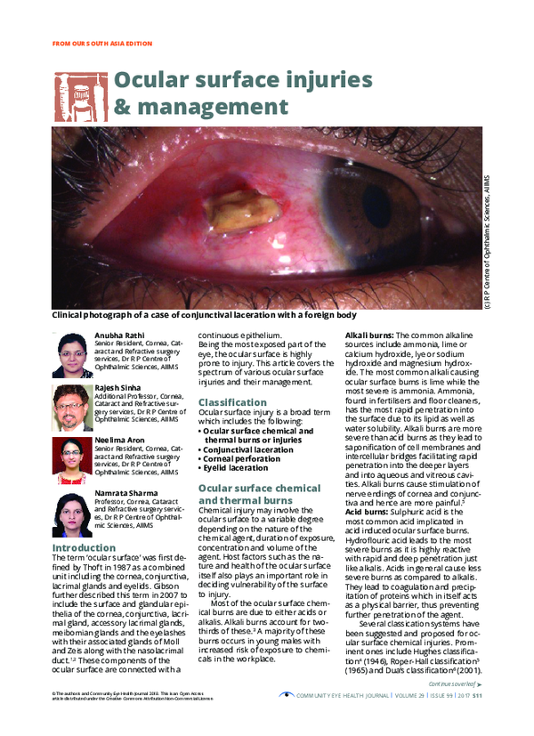 (PDF) Ocular surface injuries & management