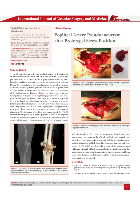 (PDF) Popliteal Artery Pseudoaneurysm after Prolonged Stress Position