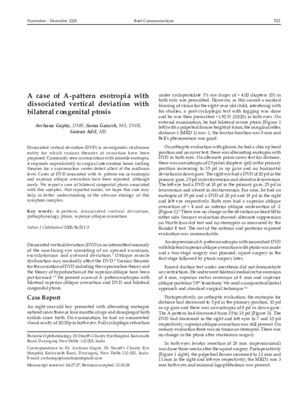 (PDF) A case of A-pattern esotropia with dissociated vertical deviation ...