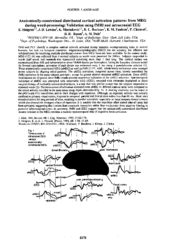 (PDF) Anatomically-constrained distributed cortical activation patterns from MEG during word ...