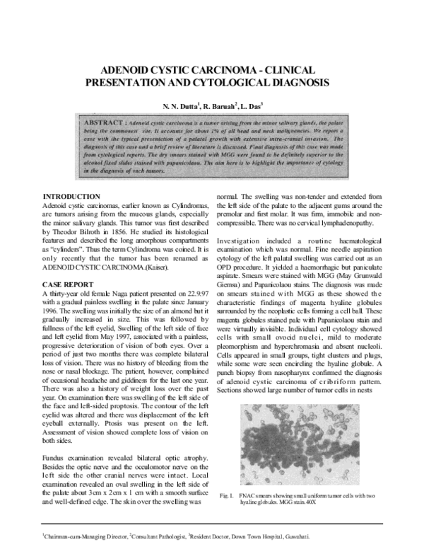(PDF) Adenoid cystic carcinoma - Clinical presentation and cytological ...
