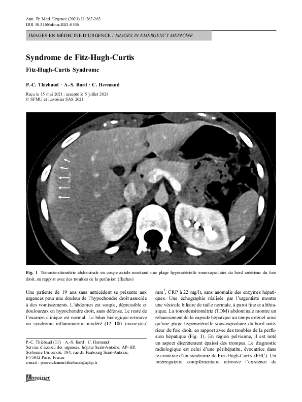 (PDF) Syndrome de Fitz-Hugh-Curtis