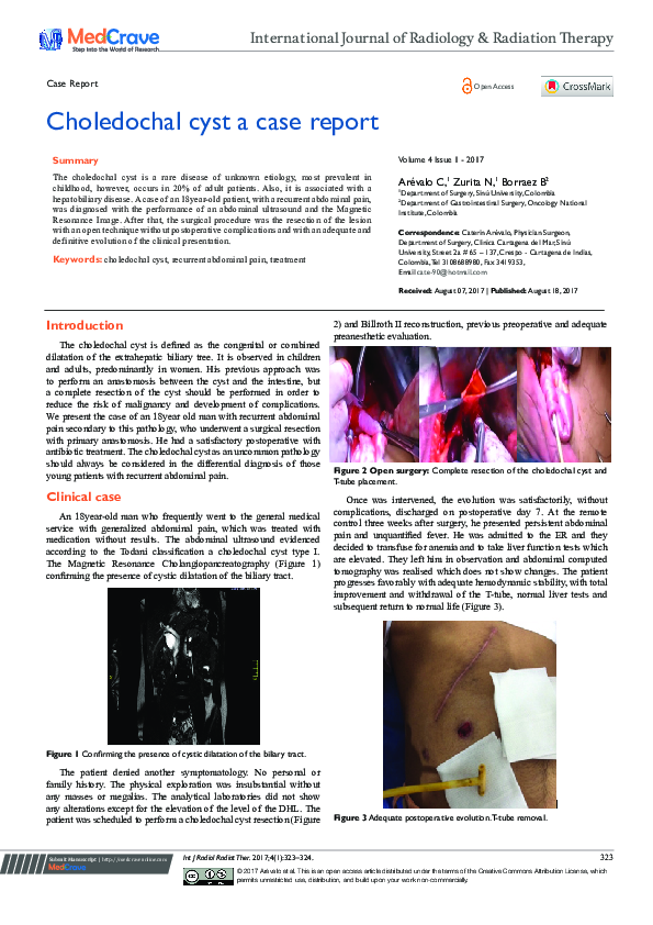 (PDF) Choledochal Cyst: A Case Report