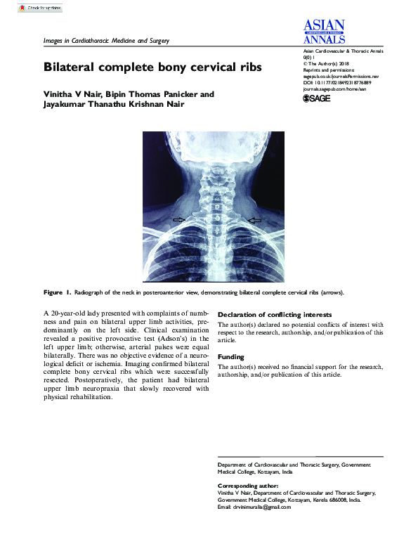 (PDF) Bilateral complete bony cervical ribs