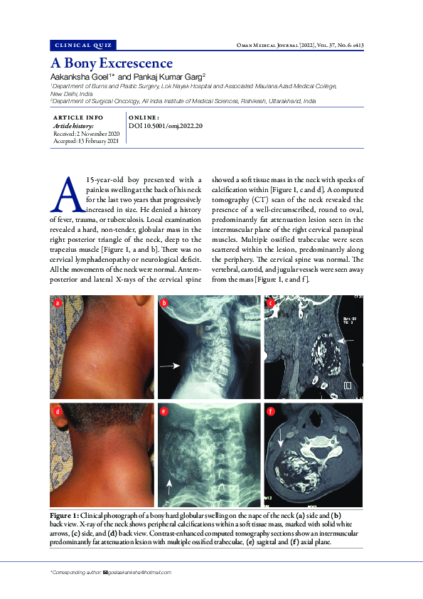 (PDF) A Bony Excrescence