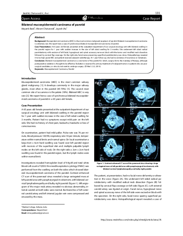 (PDF) Parotid mucoepidermoid carcinoma with extensive intravenous ...