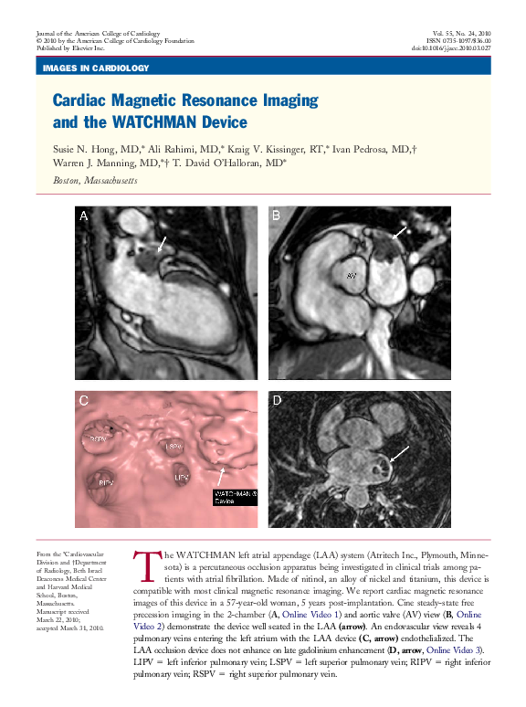 (PDF) Cardiac Magnetic Resonance Imaging and the WATCHMAN Device | Ali ...