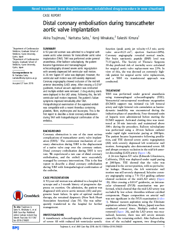 (PDF) Distal coronary embolisation during transcatheter aortic valve ...