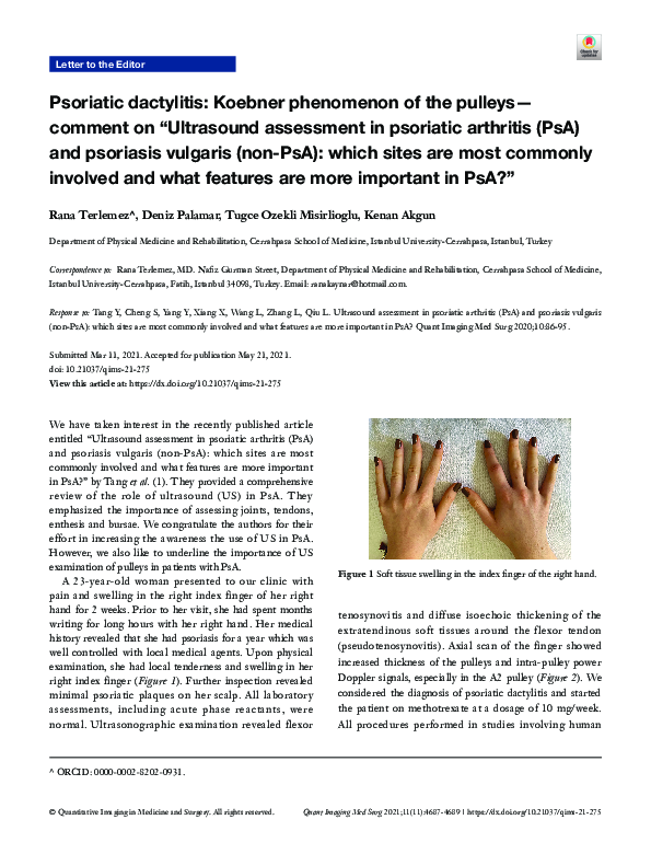 (PDF) Psoriatic dactylitis: Koebner phenomenon of the pulleys—comment ...