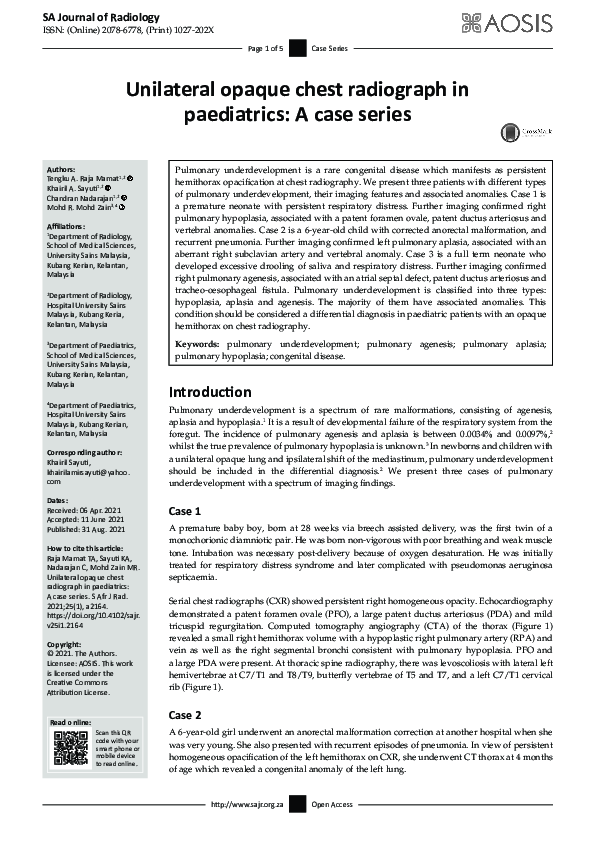 (PDF) Unilateral opaque chest radiograph in paediatrics: A case series
