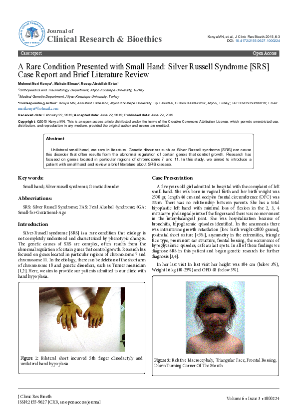 (PDF) A Rare Condition Presented with Small Hand: Silver Russell Syndrome [SRS] Case Report and ...