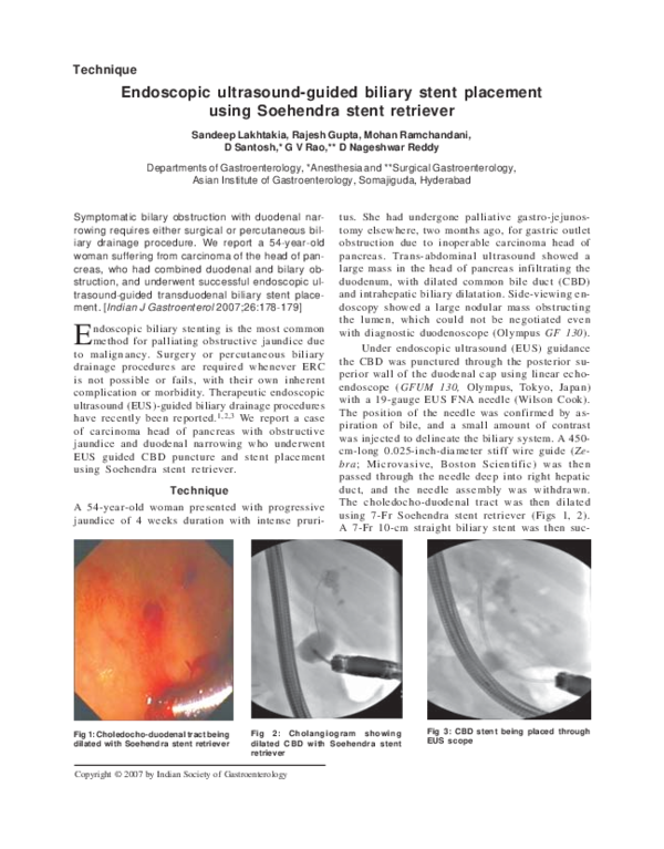 (PDF) Endoscopic ultrasound-guided biliary stent placement using ...