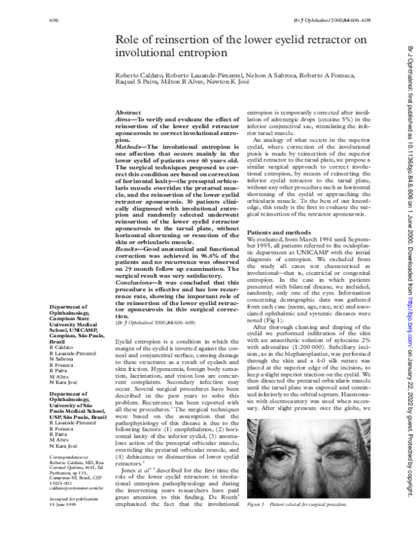 (PDF) Role of reinsertion of the lower eyelid retractor on involutional ...