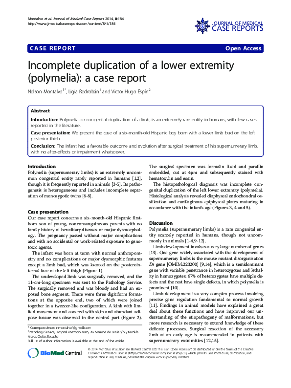 (PDF) Incomplete duplication of a lower extremity (polymelia): a case ...