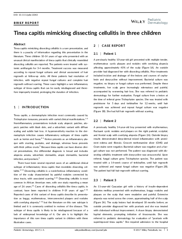 (PDF) Tinea Capitis Mimicking Dissecting Cellulitis | Jane Bellet ...
