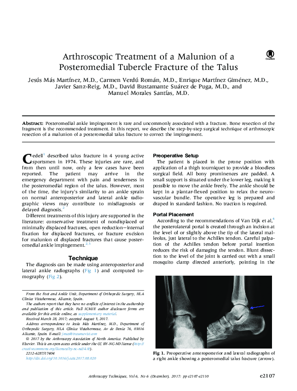 (PDF) Arthroscopic Treatment of a Malunion of a Posteromedial Tubercle ...