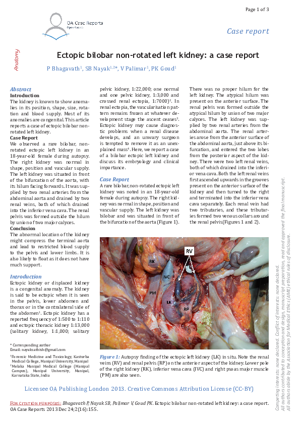 (PDF) Ectopic bilobar non-rotated left kidney: a case report