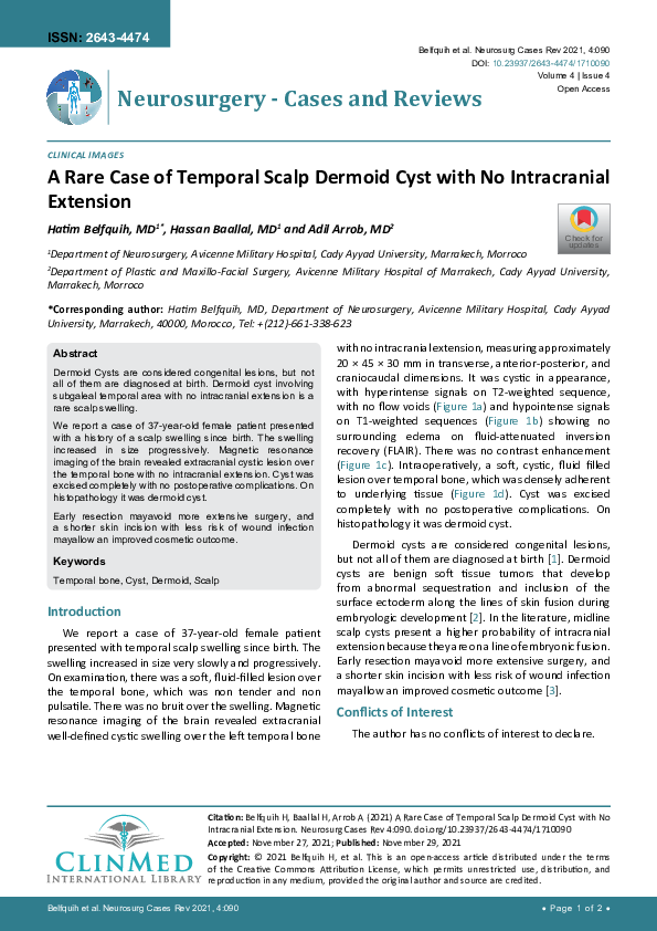 Pdf A Rare Case Of Temporal Scalp Dermoid Cyst With No Intracranial