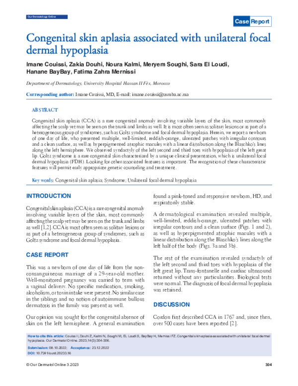 (PDF) Congenital skin aplasia associated with unilateral focal dermal ...