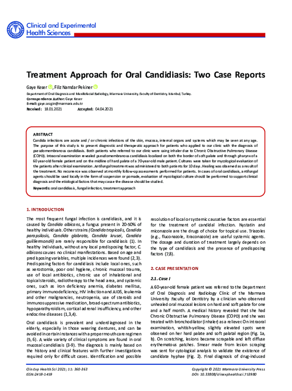 (PDF) Treatment Approach for Oral Candidiasis: Two Case Reports