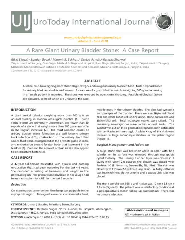 (PDF) A Rare Giant Urinary Bladder Stone: A Case Report