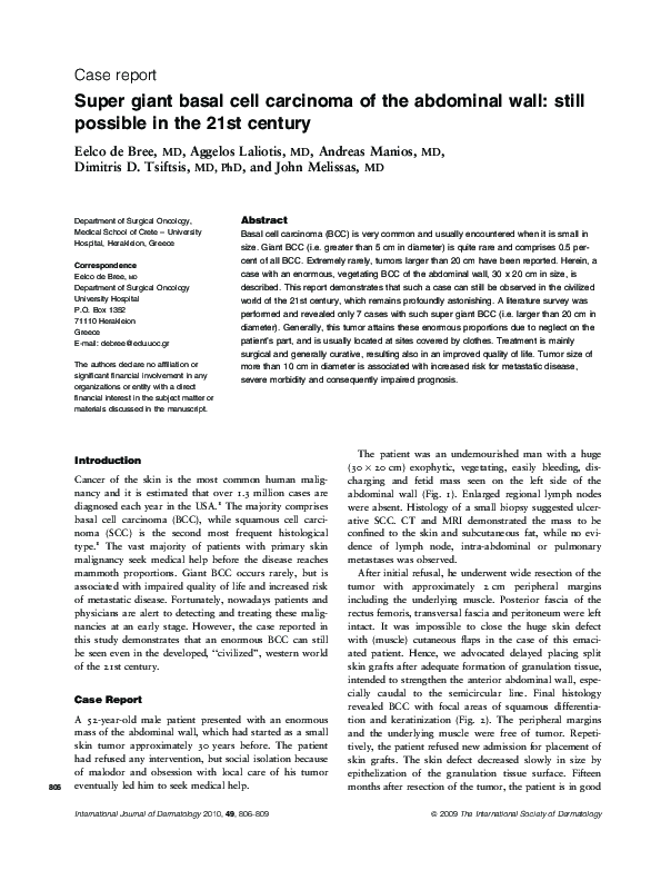 (PDF) Super giant basal cell carcinoma of the abdominal wall: still ...