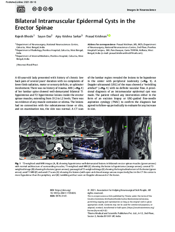 (PDF) Bilateral Intramuscular Epidermal Cysts in the Erector Spinae