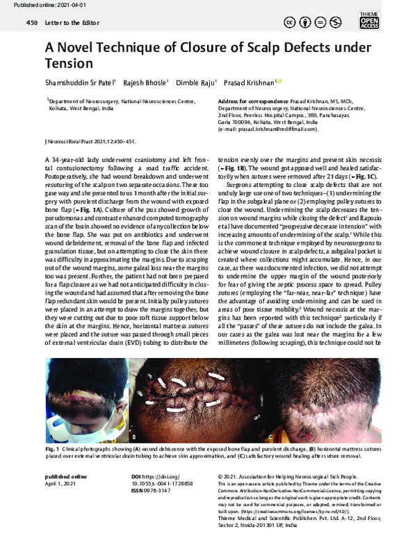 (PDF) A Novel Technique of Closure of Scalp Defects under Tension ...
