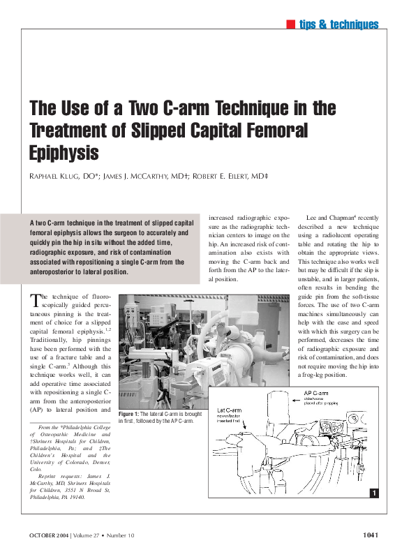 (PDF) The Use of a Two C-arm Technique in the Treatment of Slipped ...