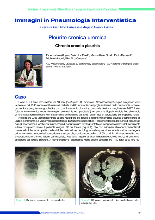 (PDF) Pleurite cronica uremica