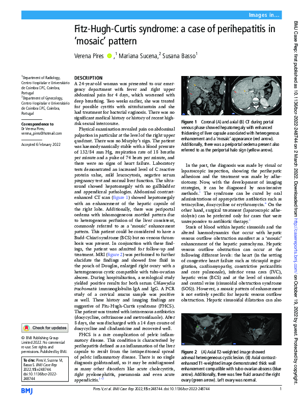 (PDF) Fitz-Hugh-Curtis syndrome: a case of perihepatitis in ‘mosaic ...