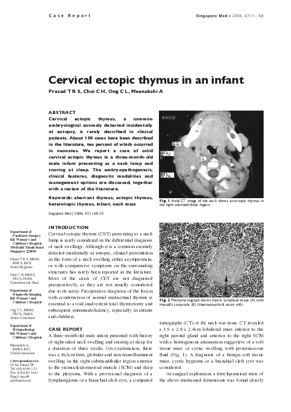(PDF) Cervical ectopic thymus in an infant