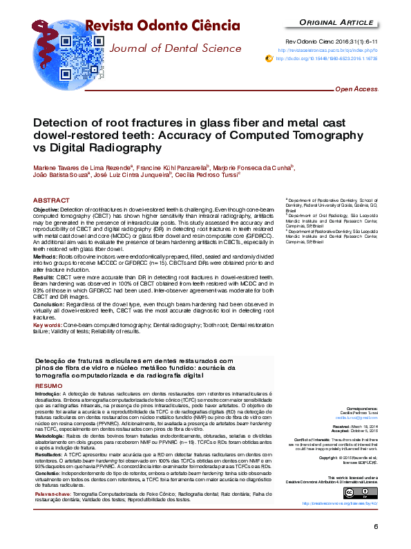 (PDF) Detection of root fractures in glass fiber and metal cast dowel ...