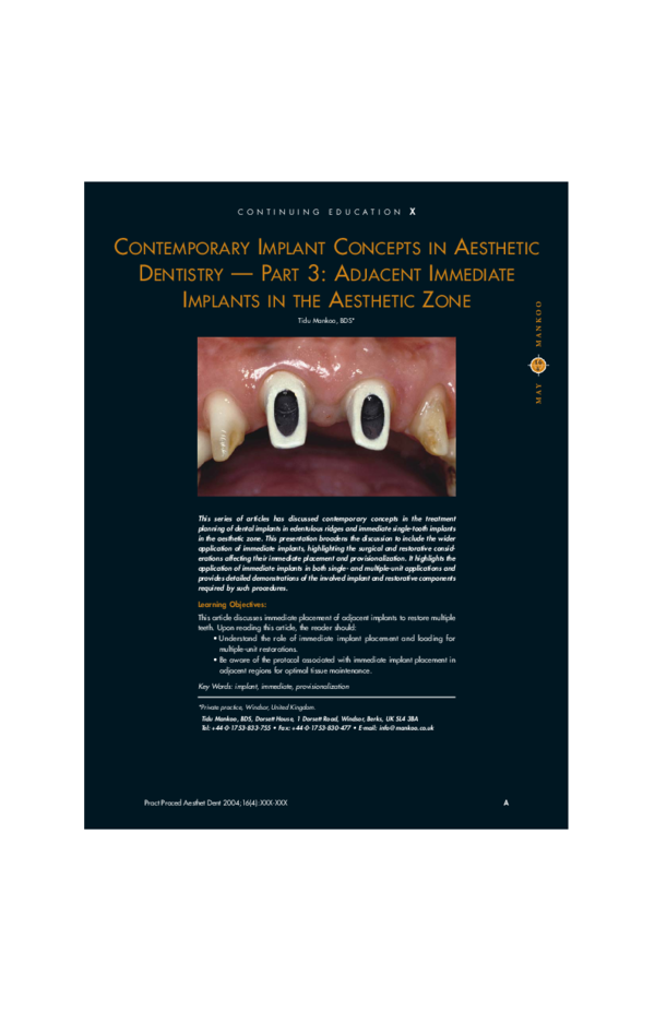 (PDF) Contemporary Implant Concepts in Aesthetic Dentistry — Part 1